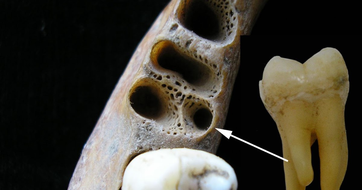 Historia y Arqueología: Un molar apunta a que hubo hibridación entre ...