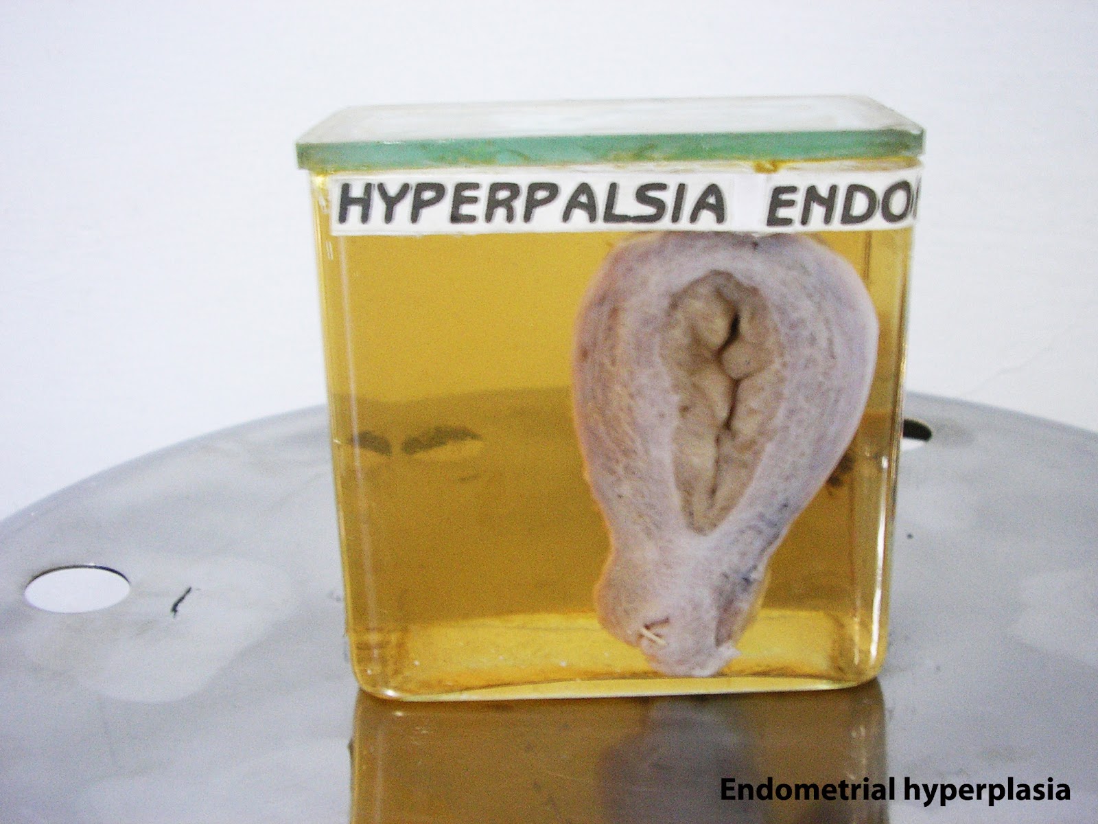 Medical Education for Students: Gross Specimens General Pathology (50 ...