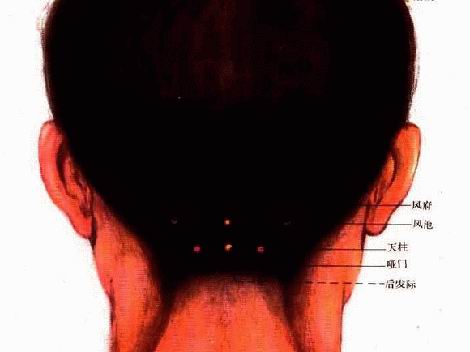 Spikenard and Myrrh: The Bone-setting Therapy in Traditional Chinese ...