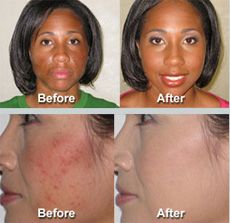 1bestof : What is celltone cream