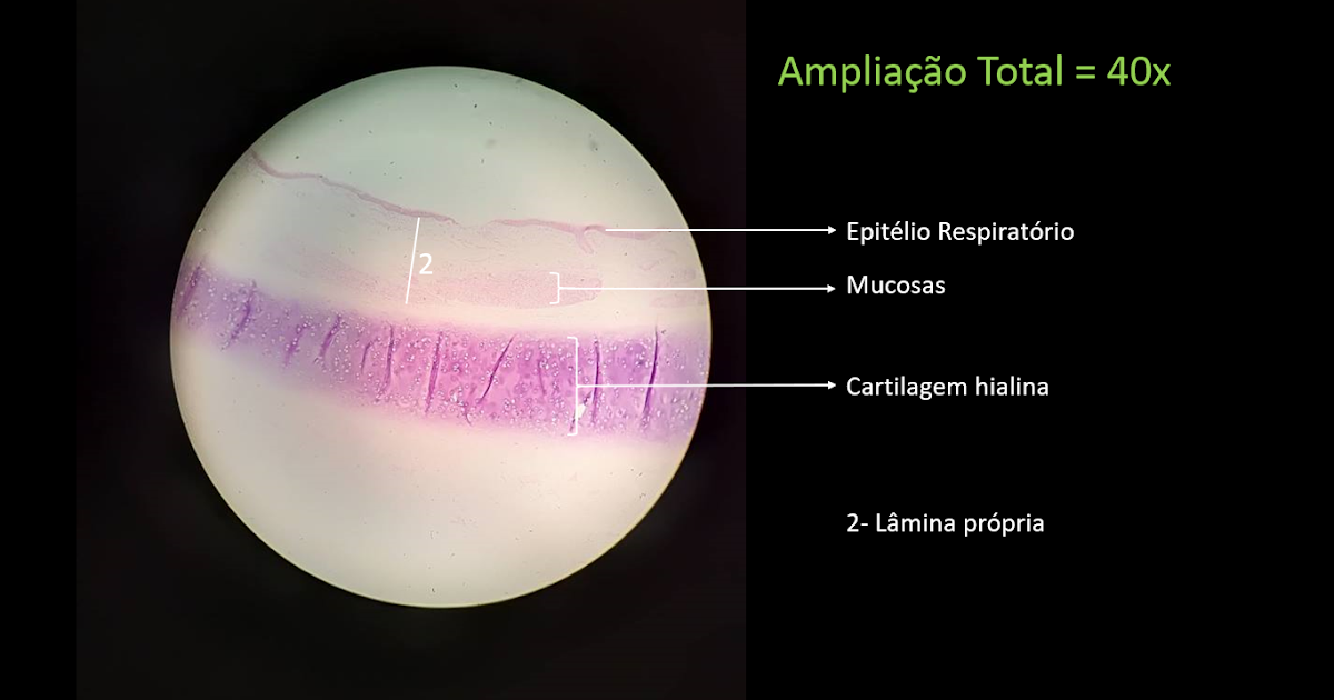 Histologia e Embriologia: Traqueia