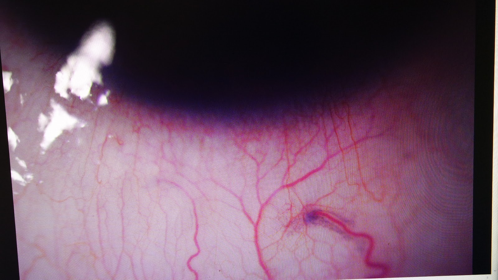 SP: Let your eyes shine with Acuvue | Tiffany Lim