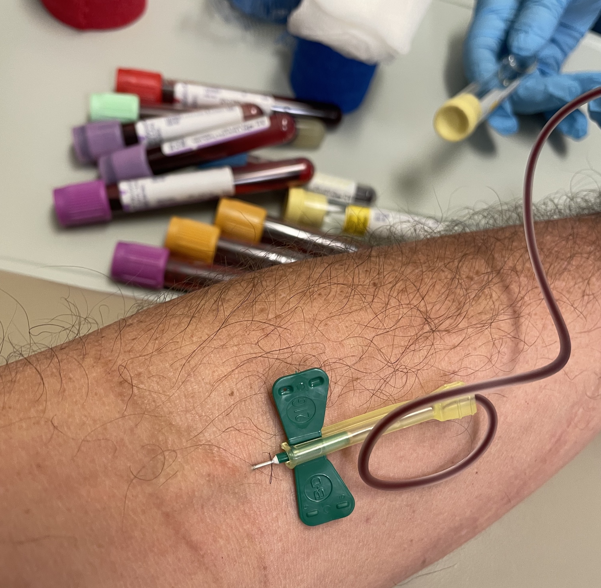 Your Hip Bone Connected to Your Back Bone