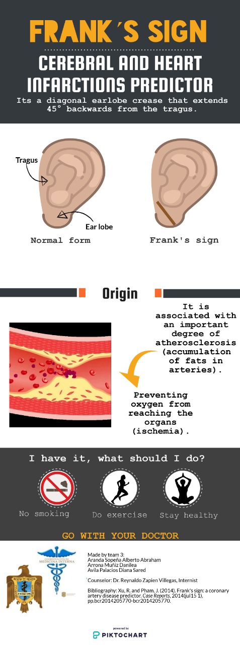Frank's Sign - DIVULGACIÓN CIENTÍFICA UG