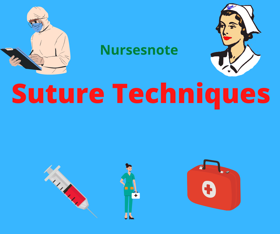 Sutures. What are the types of sutures? Suture techniques - Nurses Note