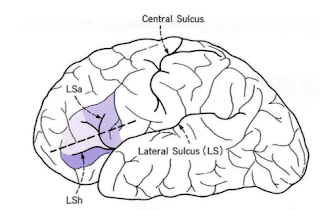 【言語表出の障害】 失語 構音障害 発話失行 aphasia, apraxia of speech, aphonia, aphemia ...