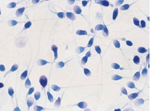 ¿CÓMO INTERPRETAR UN SEMINOGRAMA? - ¿Hablamos sobre reproducción asistida?