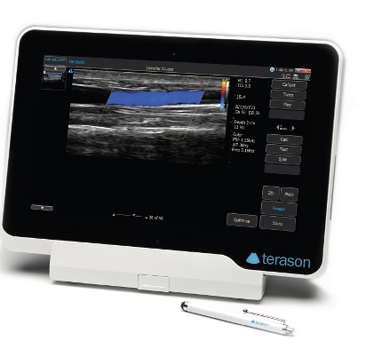 Tecnicos Radiologos: Primer Ecógrafo portátil y en versión Tablet