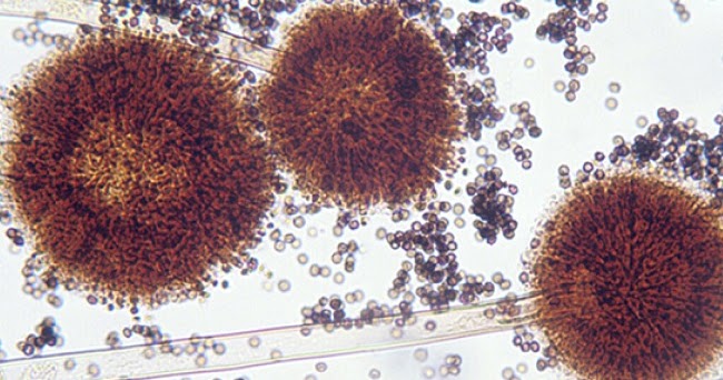 Mengapa Sebagian Besar Anggota Deuteromycotina Dikatakan Merugikan?