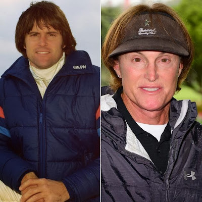 Bruce Jenner Plastic Surgery Before and After new Face (Star plastic ...