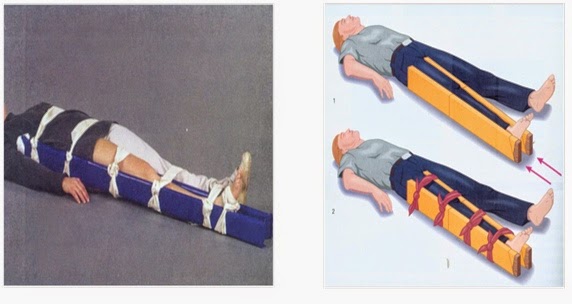 MPA-Khatulistiwa: PERTOLONGAN PERTAMA GAWAT DARURAT (PPGD)