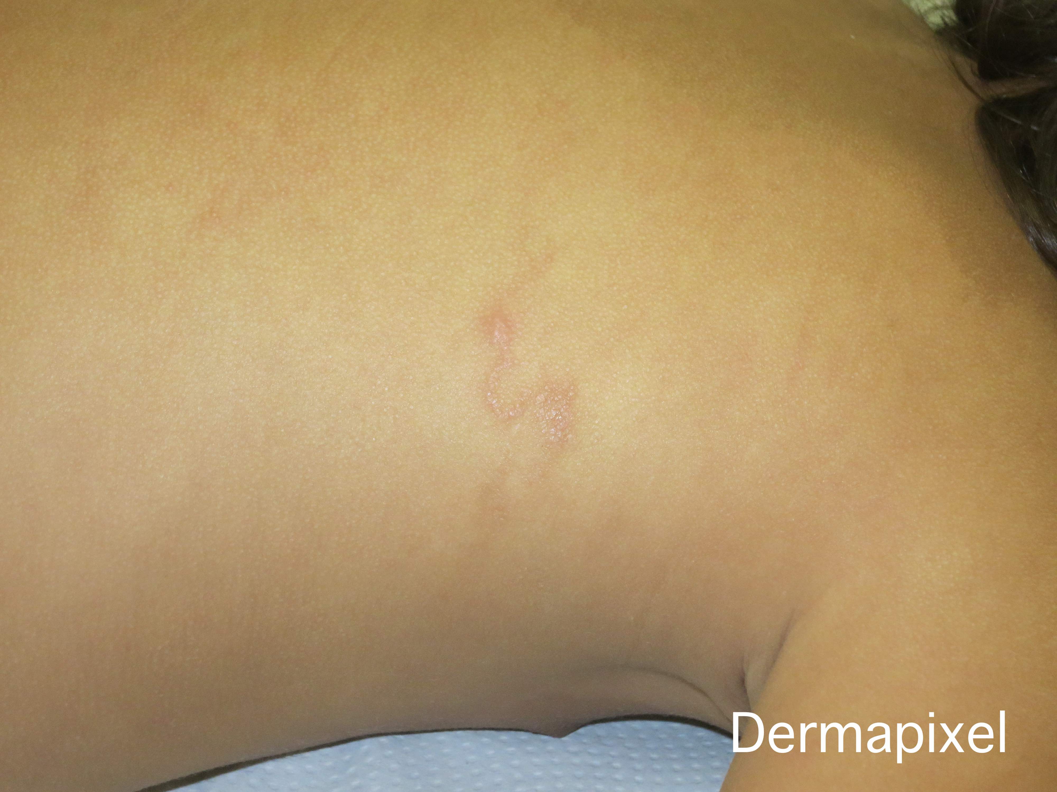 Dermapixel: julio 2020