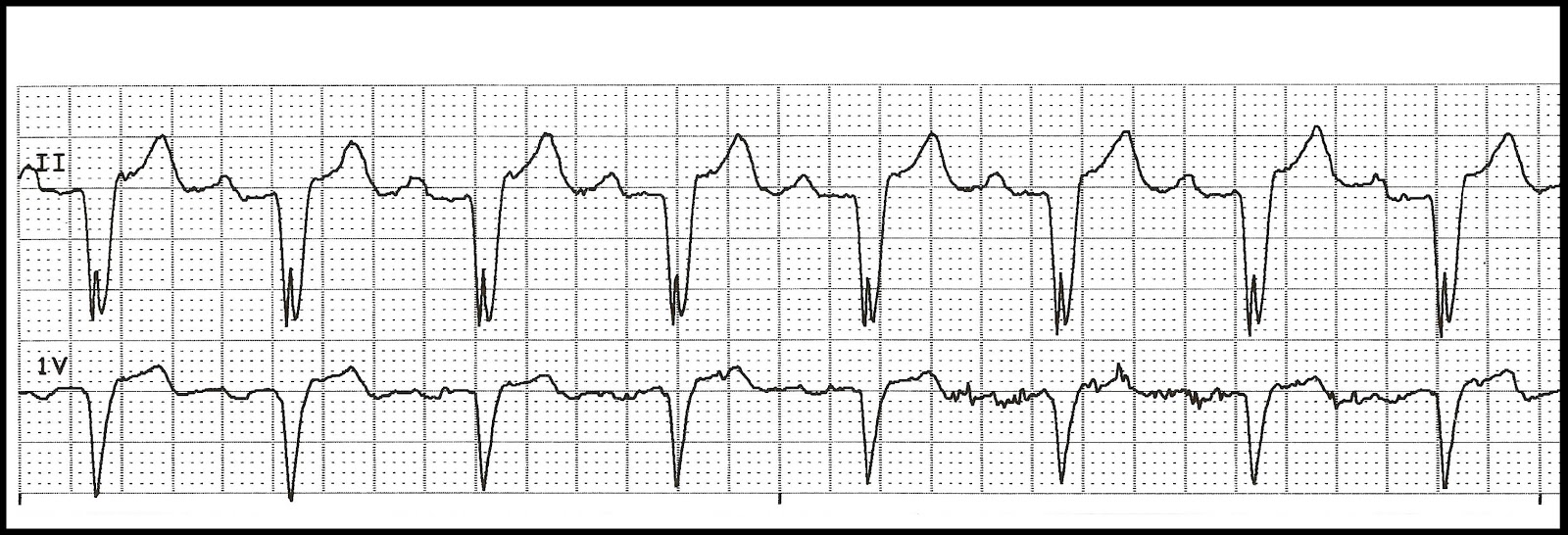 EKG Quiz 339