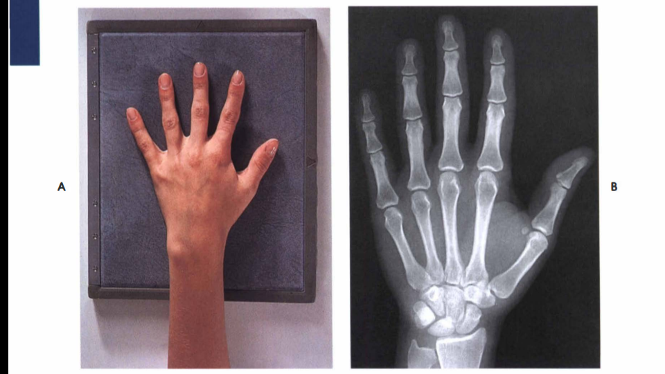 Gambaran radiograf terhadap posisi anatomi