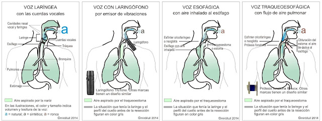 Blog de Voz: TRATAMIENTO EN PACIENTE LARINGECTOMIZADO
