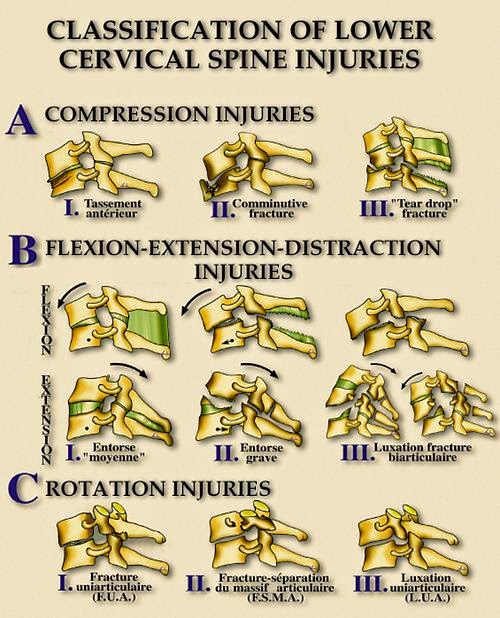 Thoracic and Cervical Spine Injury - RadTechOnDuty