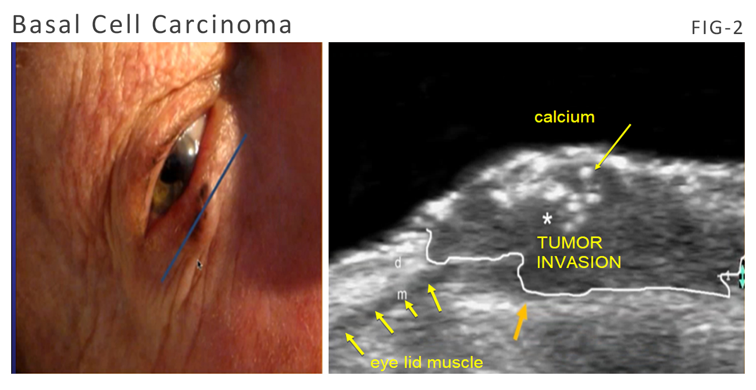 Modern Diagnostic Science: "GOT METALS?" Research Project: Imaging ...