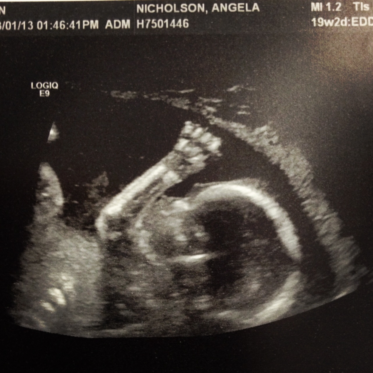 Our Journey Through Pregnancy: 19 Week Scan!