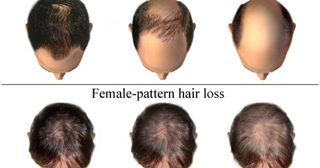 Dr Gourdas Choudhuri: Plasma therapy for Baldness to Joint Diseases