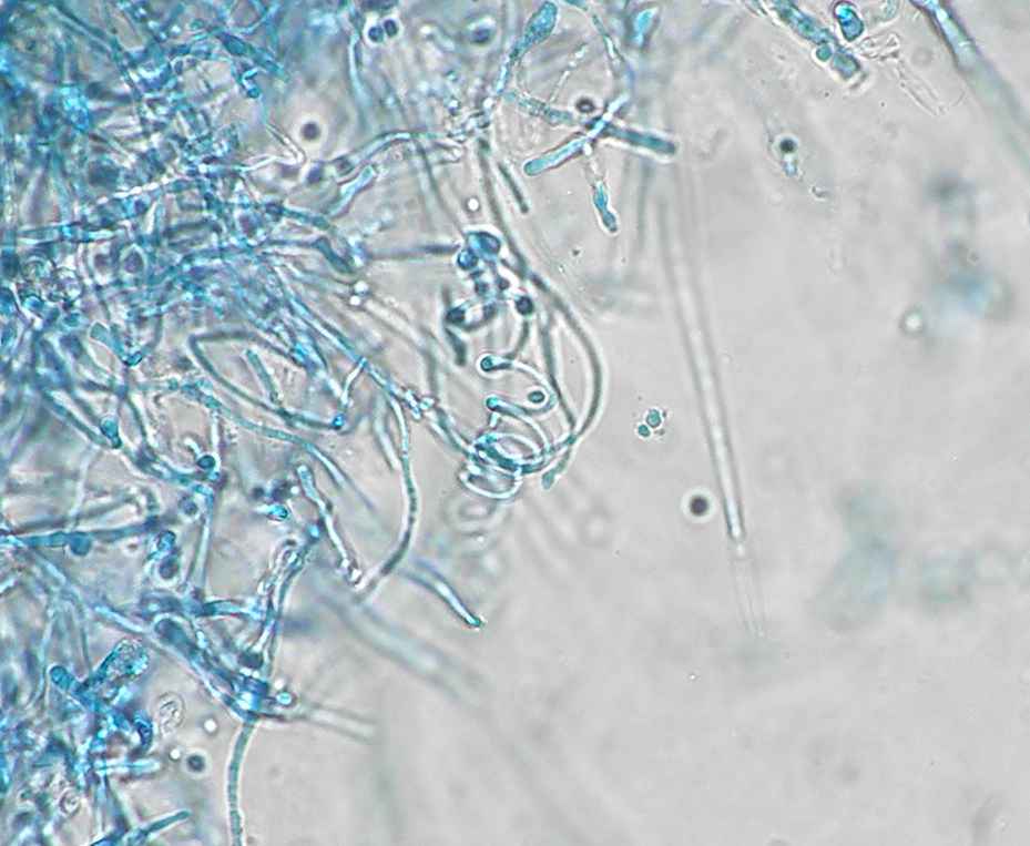 ATLAS MICOLOGIA: TRICHOPHYTON INTERDIGITALE