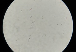 LAPORAN PRAKTIKUM MIKROBIOLOGI ALT: UJI CEMARAN MIKROBA METODE ANGKA ...