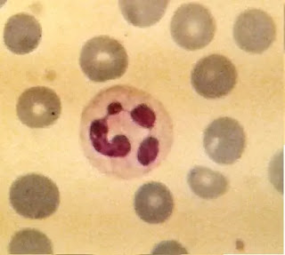 Examination of the Peripheral Blood smear