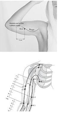 Acupuncture: HT - 2 (HEART - 2)