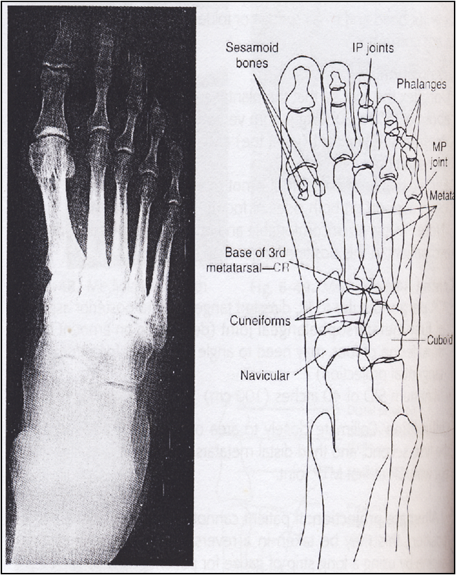 Catatan Ku: Teknik Radiografi Os Pedis