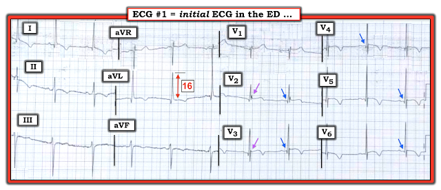 Dr. Smith's ECG Blog: November 2019