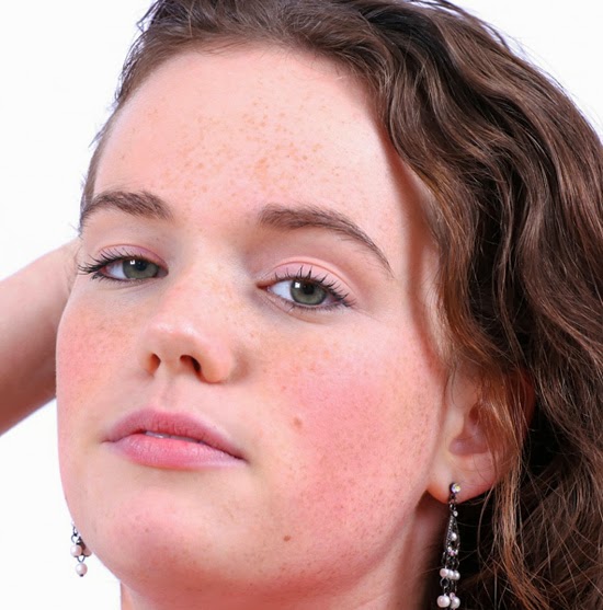 Resplendency Revealed: Blemish Girl