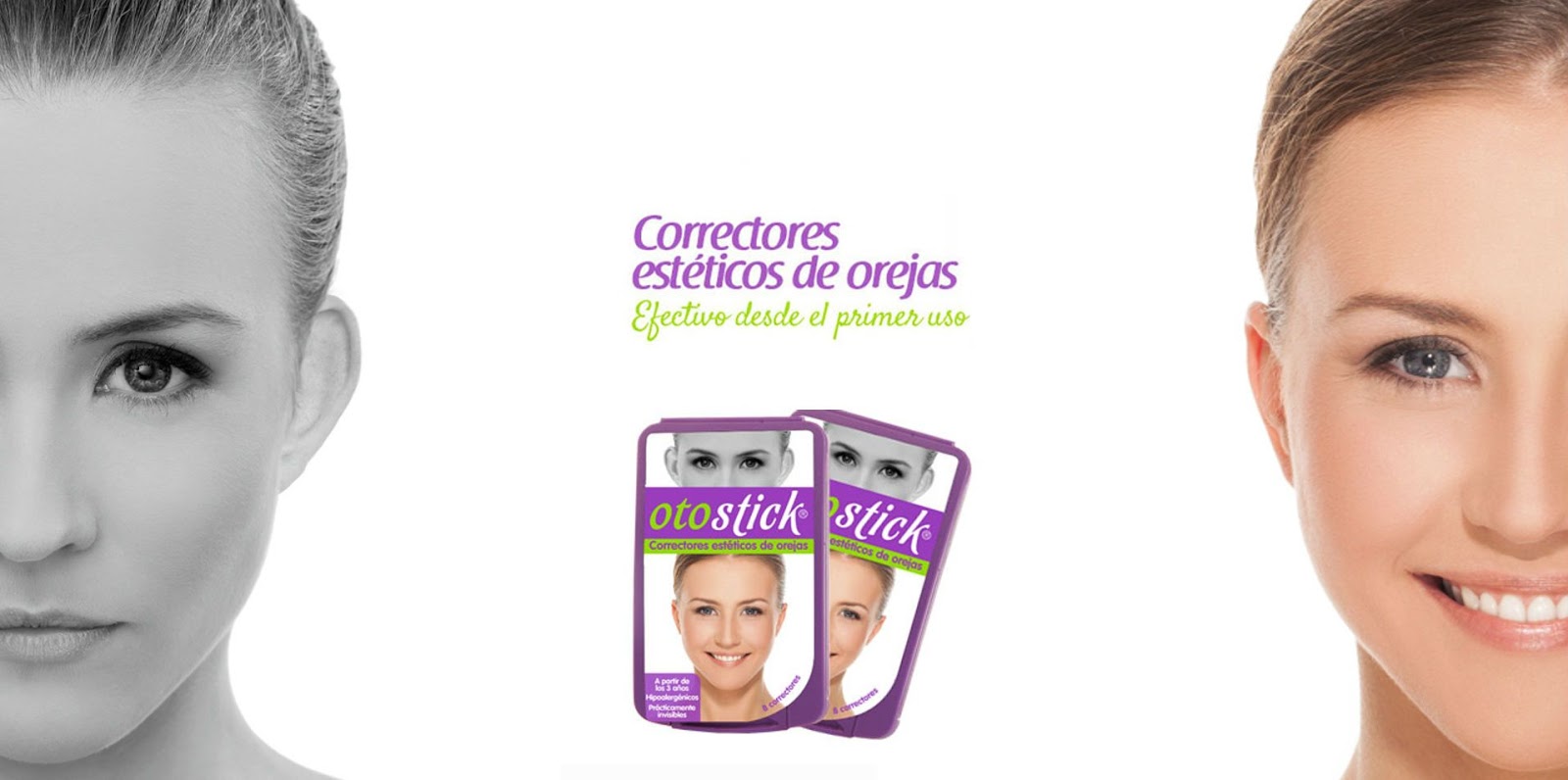 Corrector estético de orejas