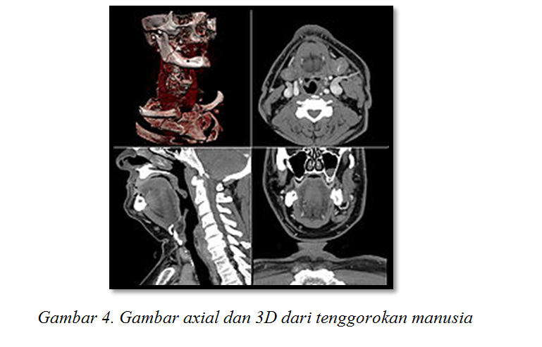 radiologi oh radiologi: CT ( Computed Tomography )