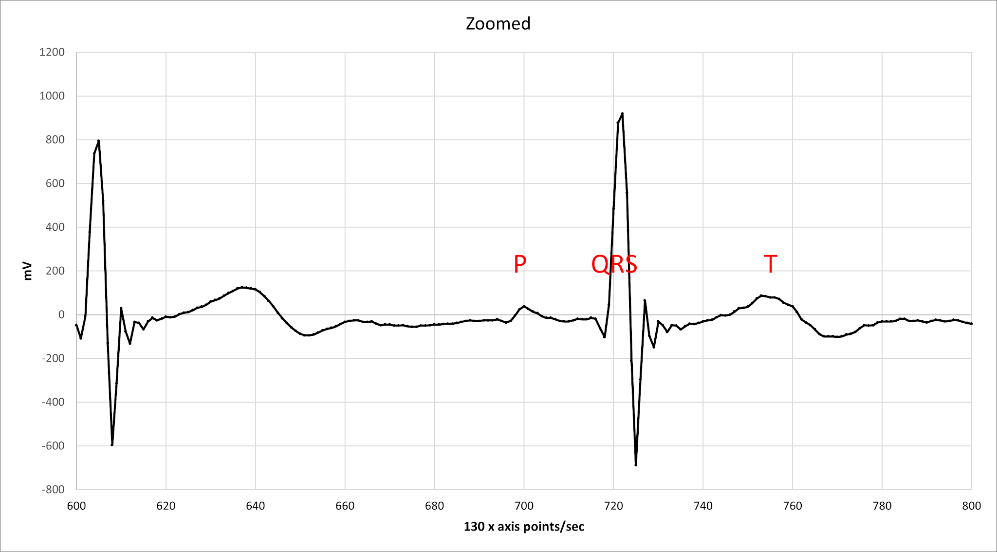 Muscle Oxygen Training: ECG artifact strips from Fatmaxxer - a guide