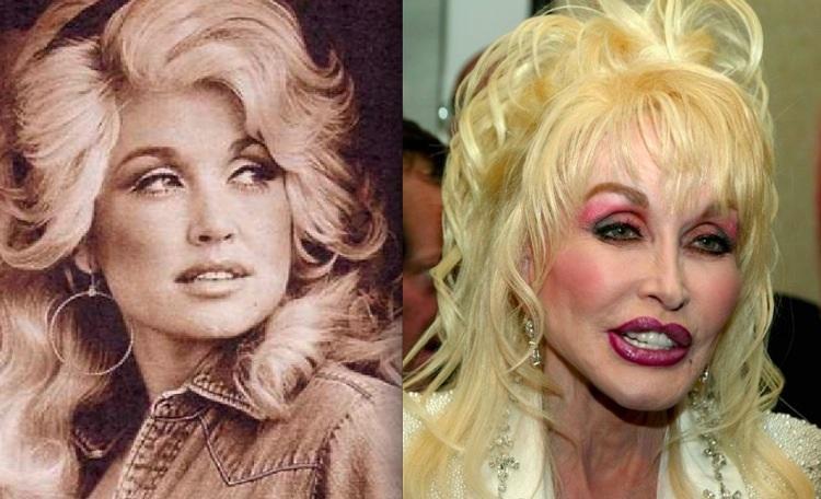 Epic Celebrity Plastic Surgery Fail You Didn't Know Of. - Vibes.NG