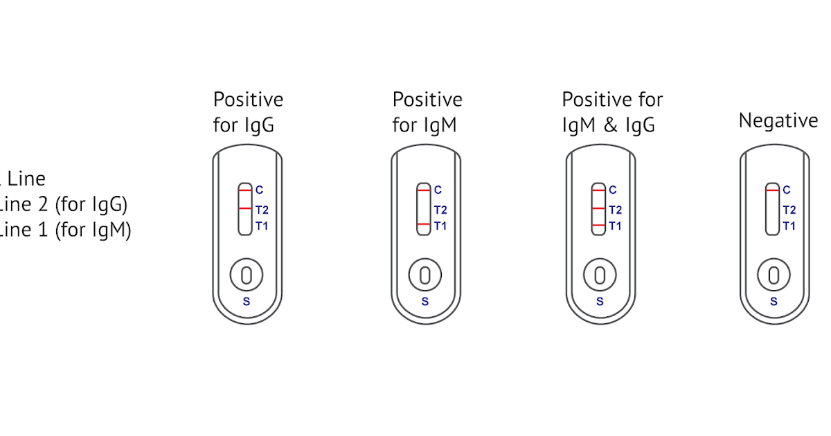 Dengue Test Procedure ~ Lab Tests Guide