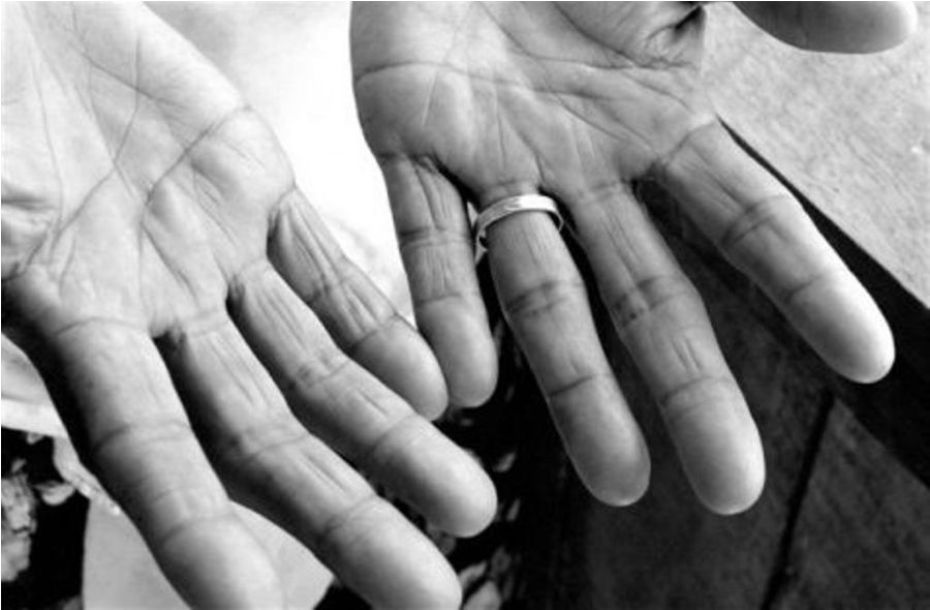 Cirandeira Poema Para As Mãos Esquerda E Direita