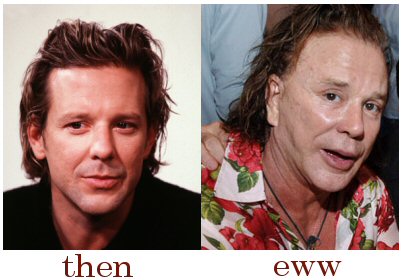 Mickey Rourke Plastic Surgery