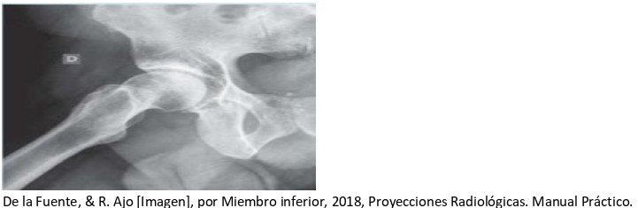 PROTOCOLOS DE LOS ESTUDIOS RADIOLÓGICOS CADERA Y PELVIS
