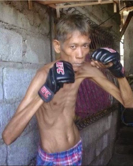 Apelidos para magrelos