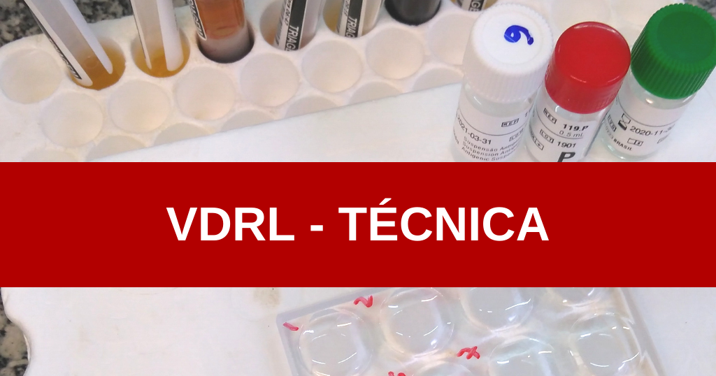 VDRL - Técnica - Tira o Jaleco