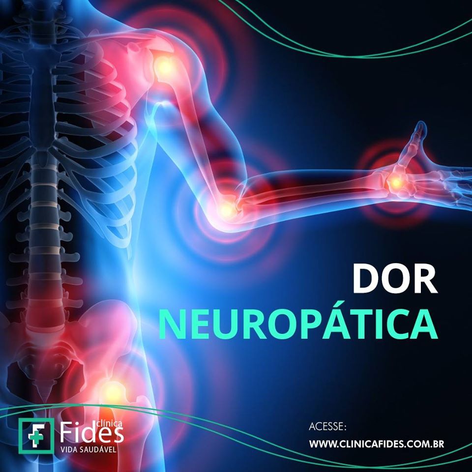 BLOG ENCONTRO COM A SAÚDE DE SOBRAL: Dor Neuropática - Clínica Fides