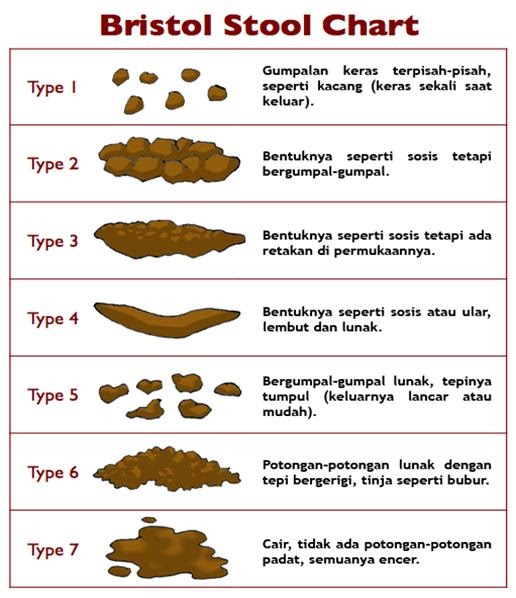 Variasi Warna dan Bentuk Tinja (Feces) Bayi : Kesehatan