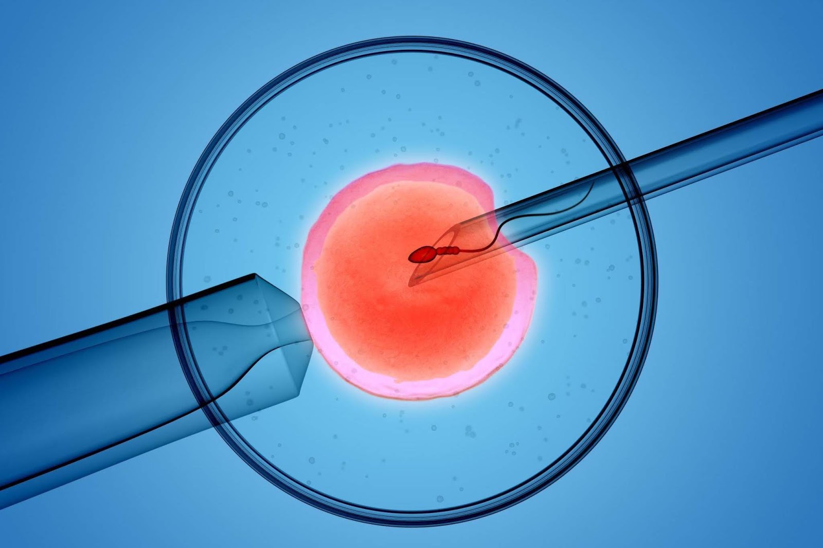 MedFriendly Medical Blog: 5 Myths About IVF Debunked