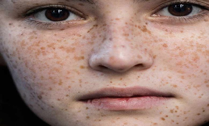 What Are The Major Skin Problems?