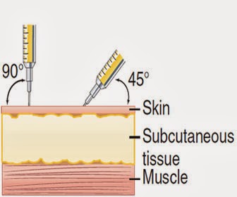 Administering Subcutaneous Medication ~ Nursing