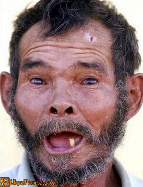 Imagens Dos Homens Mais Feios Do Mundo - ouro
