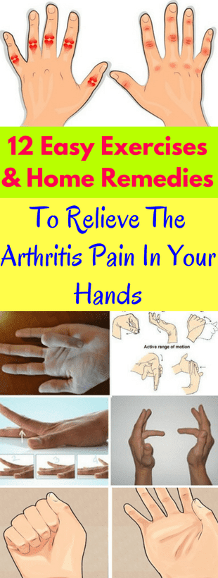 12 Easy Exercises And Home Remedies To Relieve The Arthritis Pain In ...