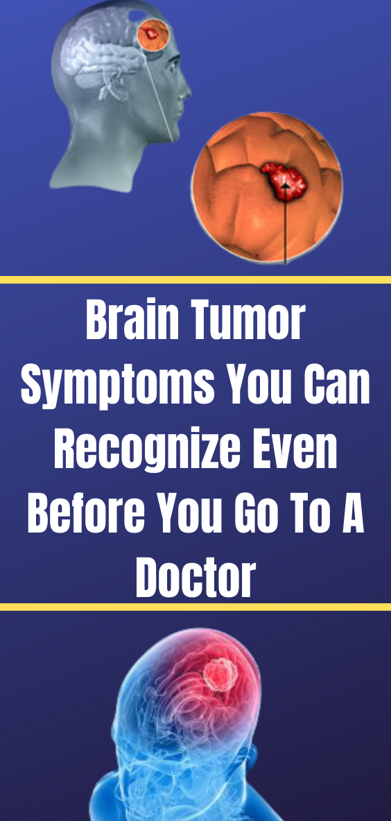 Brain Tumor Symptoms You Can Recognize Even Before You Go To A Doctor ...