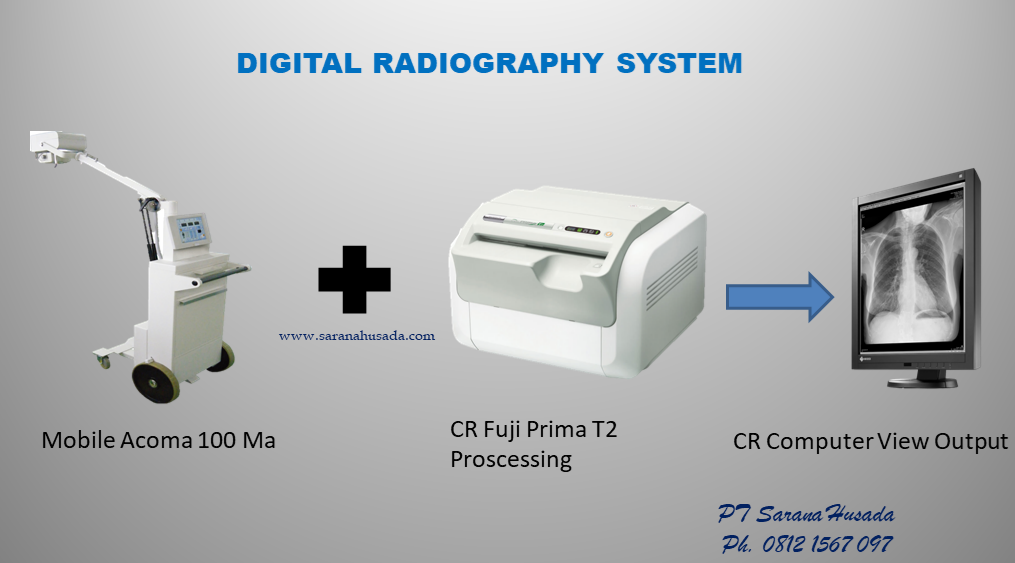 RADIOLOGI X-RAY + CR / DR ( DIGITAL RADIOLOGY ) - ALAT X-RAY, PAKET ...
