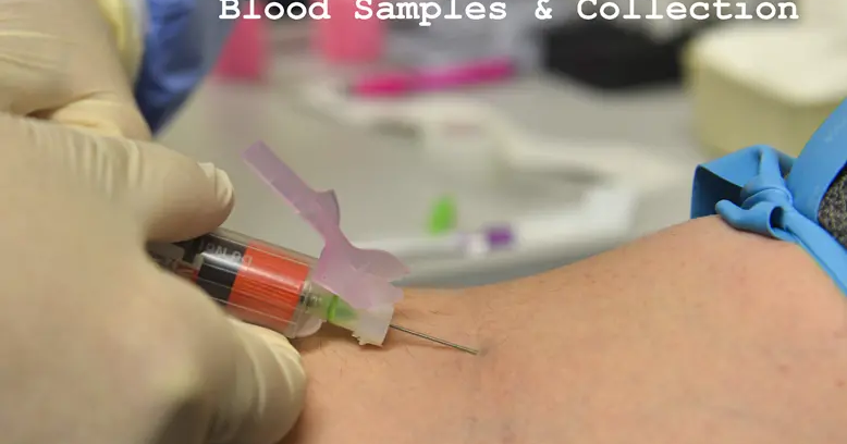 Blood Samples & Blood Collection Tubes